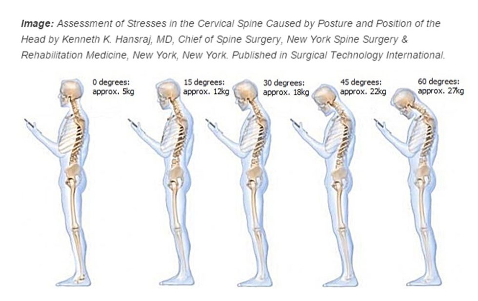Cervicothoracic Syndromes, "Tech-Neck" and Poor Postures